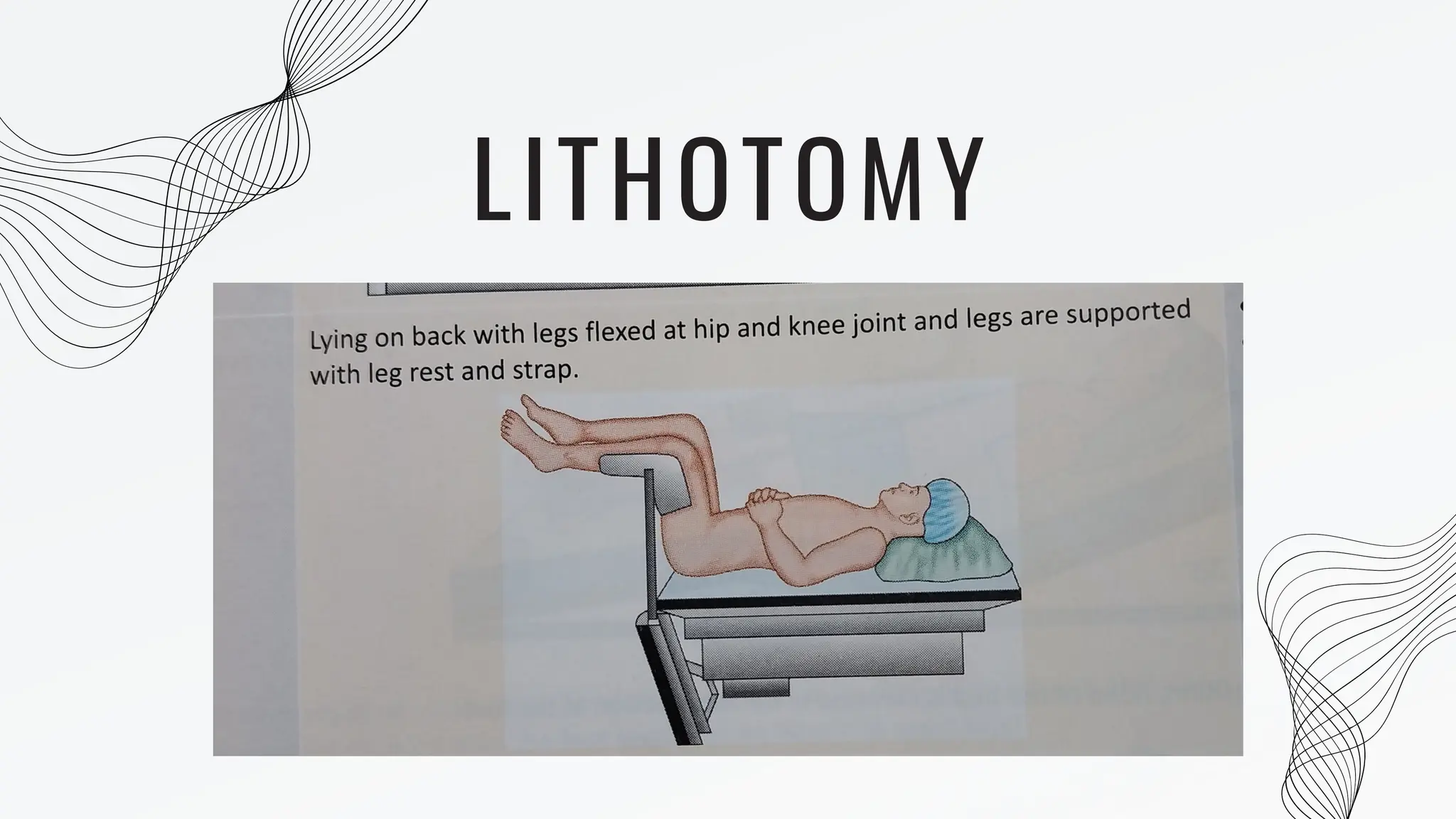 Position for patient | PDF