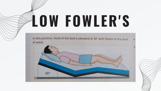 Position for patient | PPT