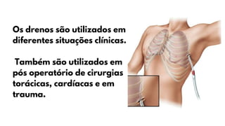 Tipos de Drenos e cuidados de Enfermagem | PDF