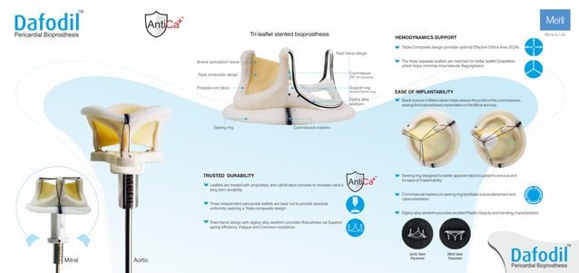 Dafodil Pericardial Bioprosthesis Brochure | PDF | Heart and ...