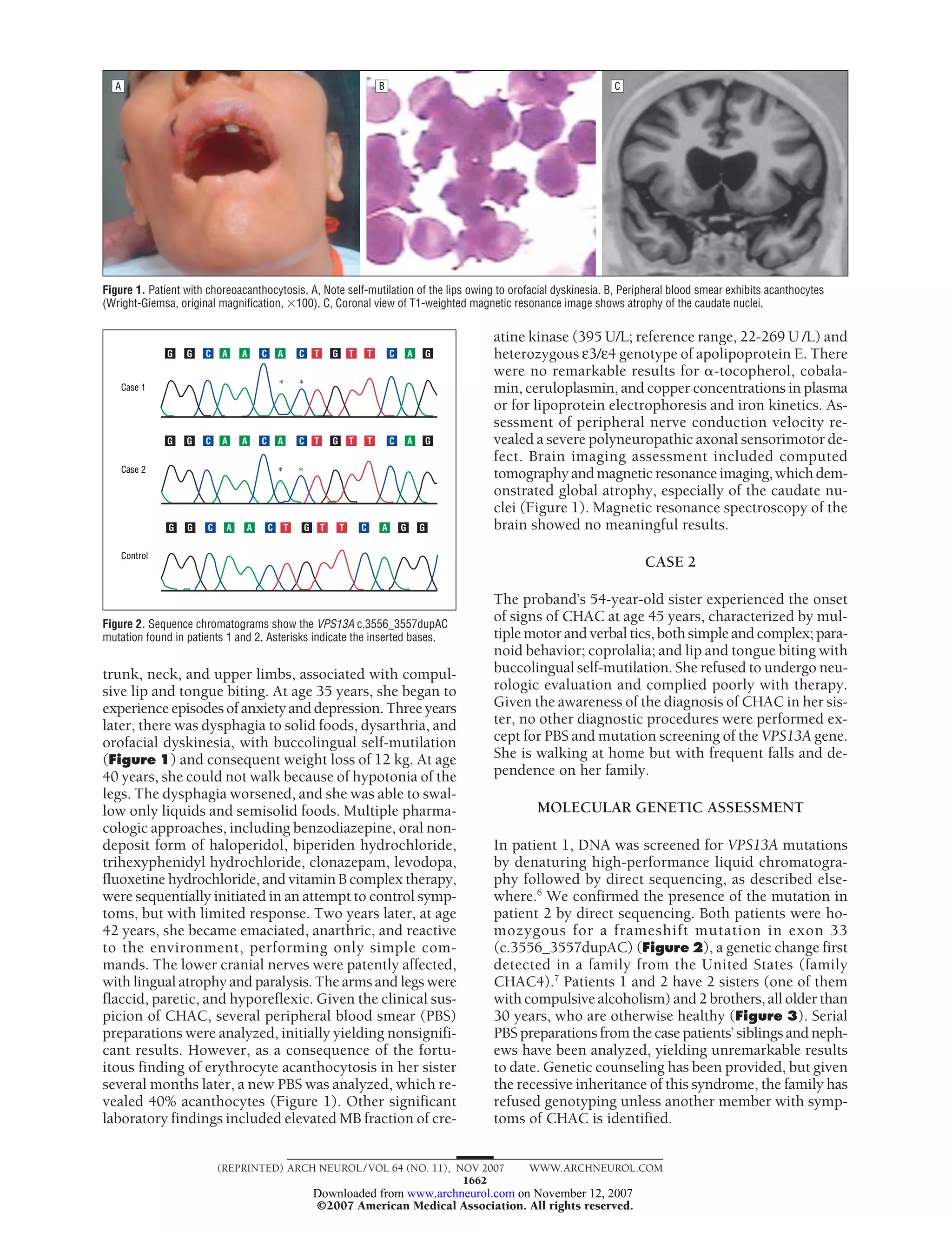 Choreoacantocytosis | PDF