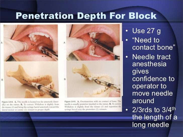 Long Island Periodontist presents "The Art and Science of the Painles…
