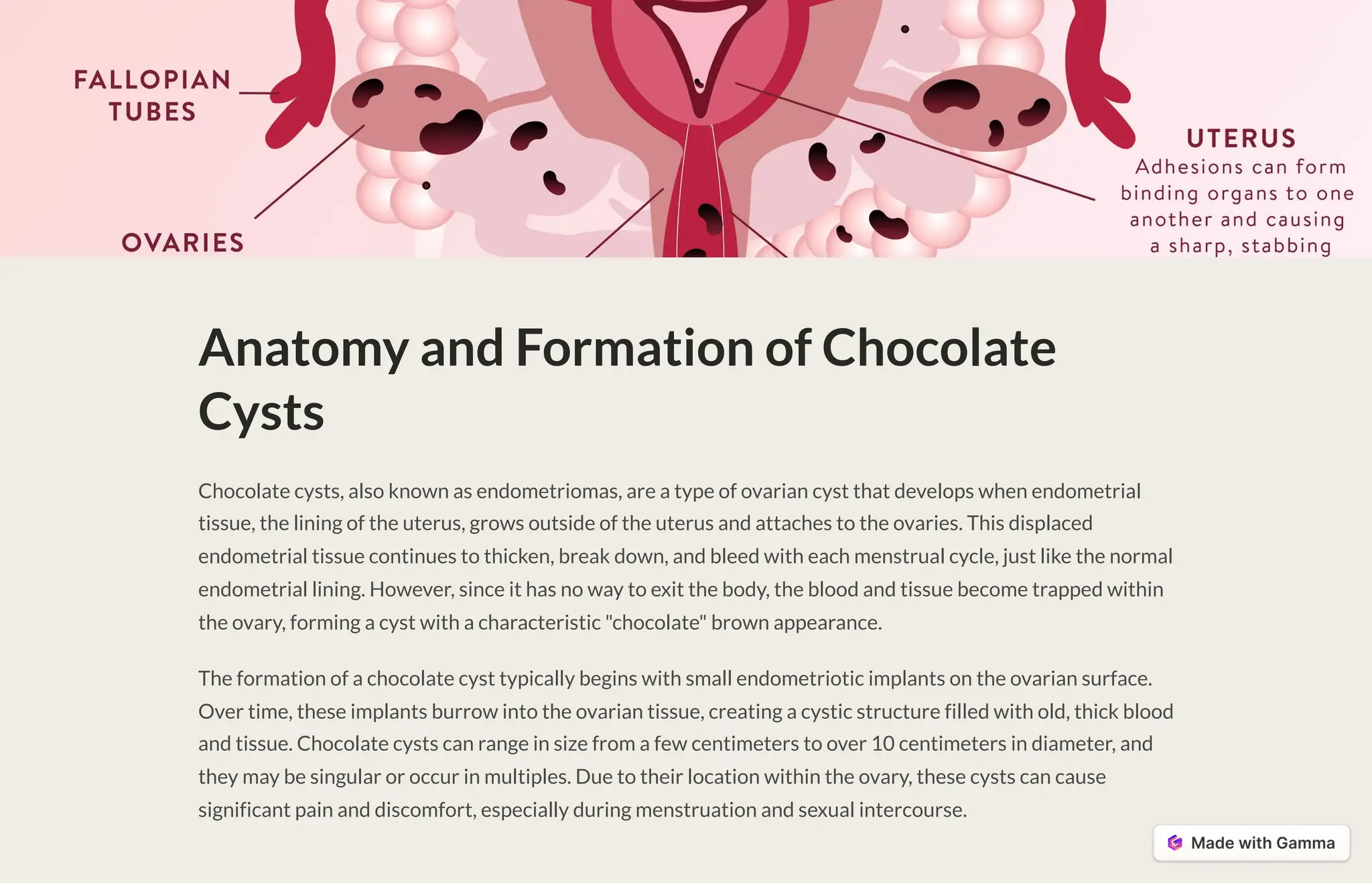 Ruptured chocolate cyst presentation ppt | PDF
