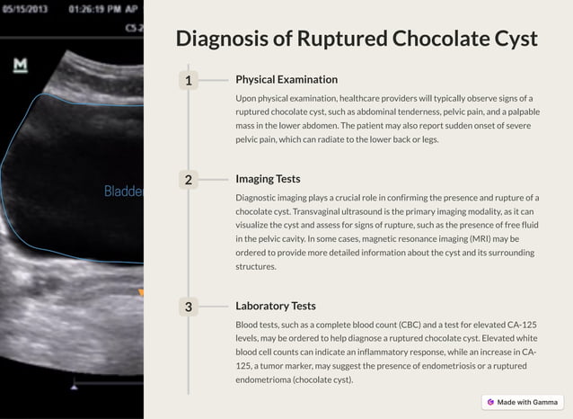 Ruptured chocolate cyst presentation ppt | PPT