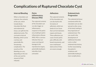 Ruptured chocolate cyst presentation ppt | PDF