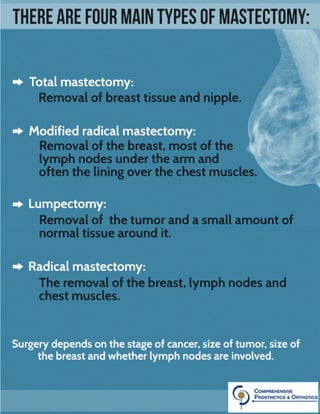 Mastectomy- Whats and Whys | PDF