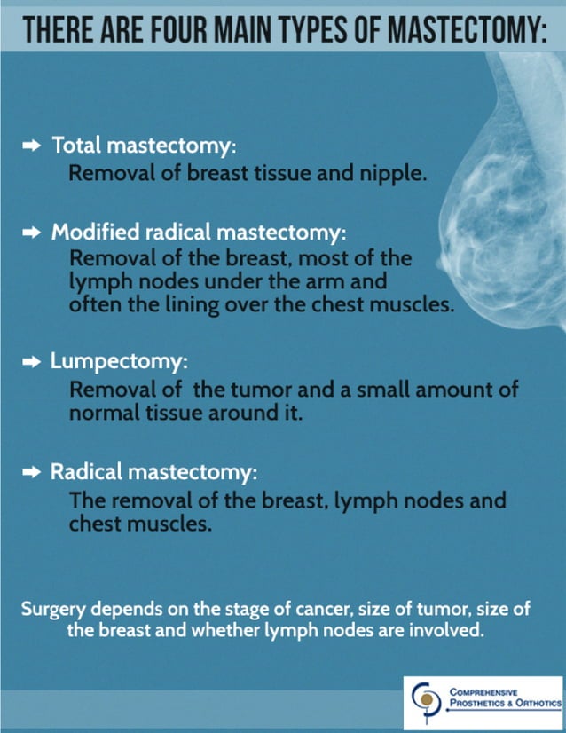 Mastectomy- Whats and Whys | PDF