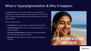 Hyperpigmentation Treatment: Your Complete Guide by Devriz Healthcare | PDF