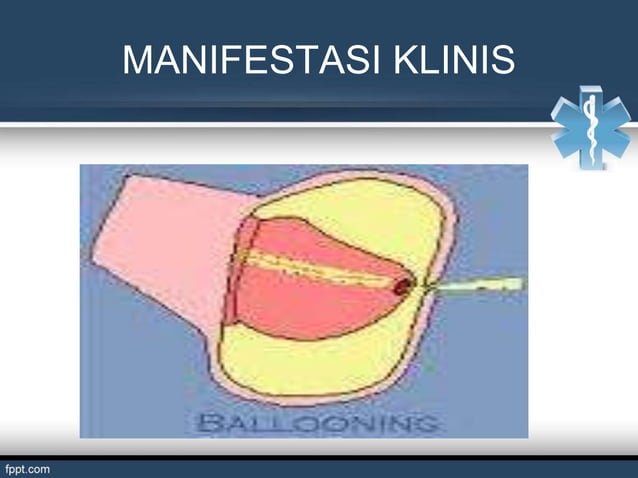 pdfslide.net_7-fimosis-dan-parafimosis.ppt