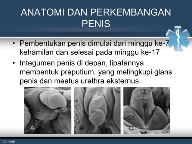pdfslide.net_7-fimosis-dan-parafimosis.ppt