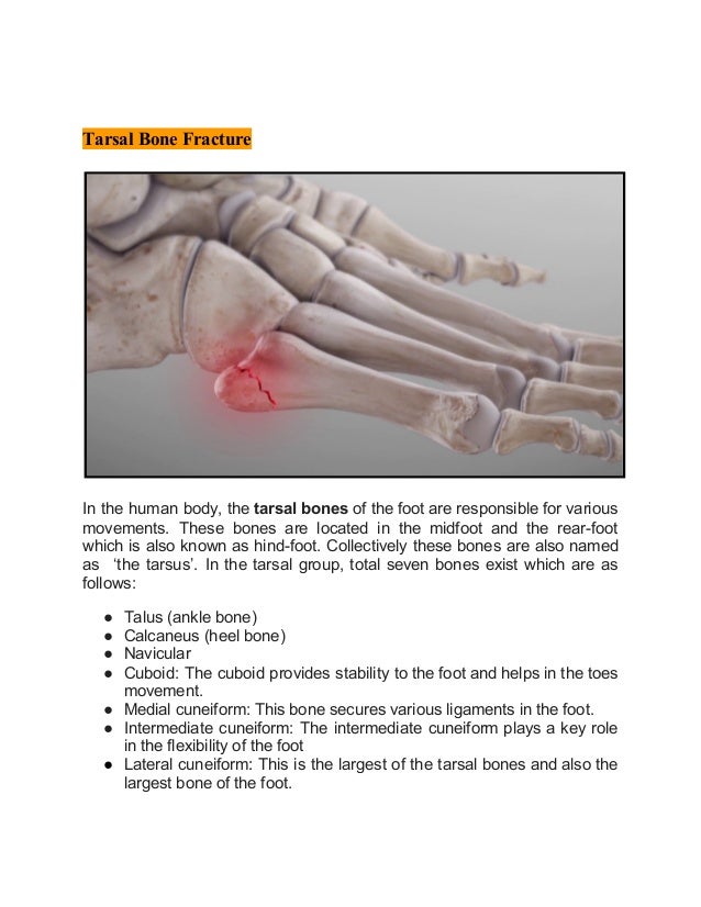 Tarsal Bone Fracture Symptoms and Treatment