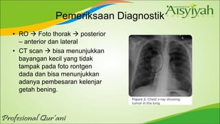 PDF Topik Fisioterapi Pada Kanker dan Oedem Paru, emboli paru.pdf