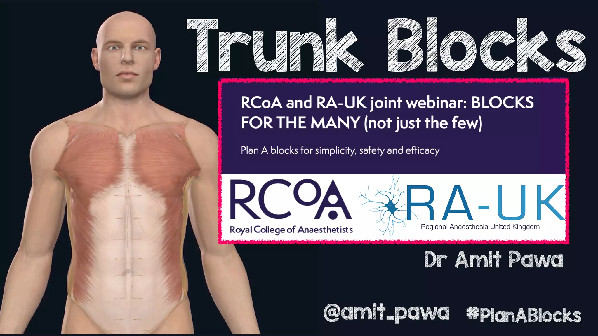 Trunk Blocks - Plan A Blocks - Royal College of Anaesthetists ...