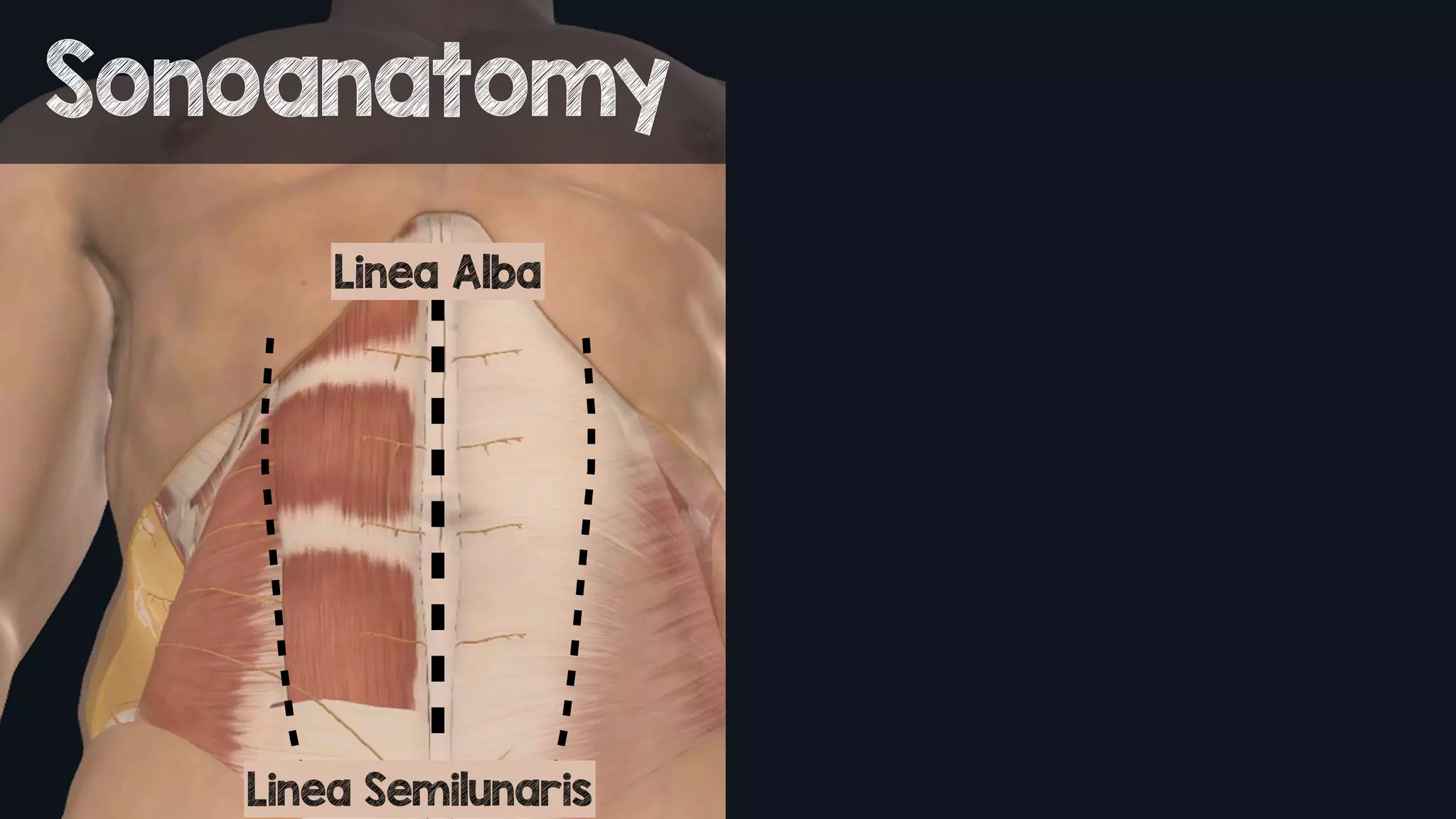Trunk Blocks - Plan A Blocks - Royal College of Anaesthetists ...