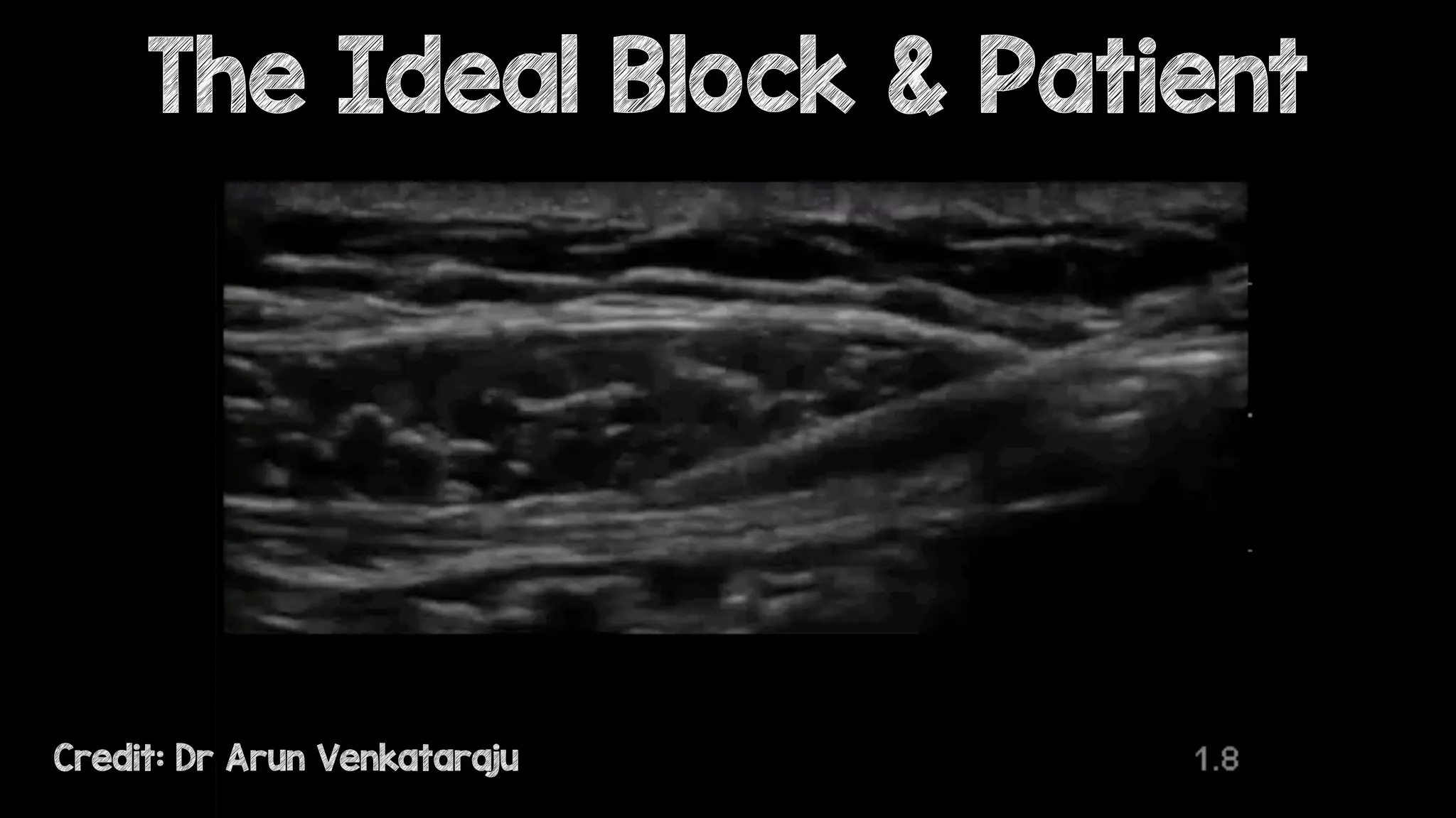Trunk Blocks - Plan A Blocks - Royal College of Anaesthetists ...