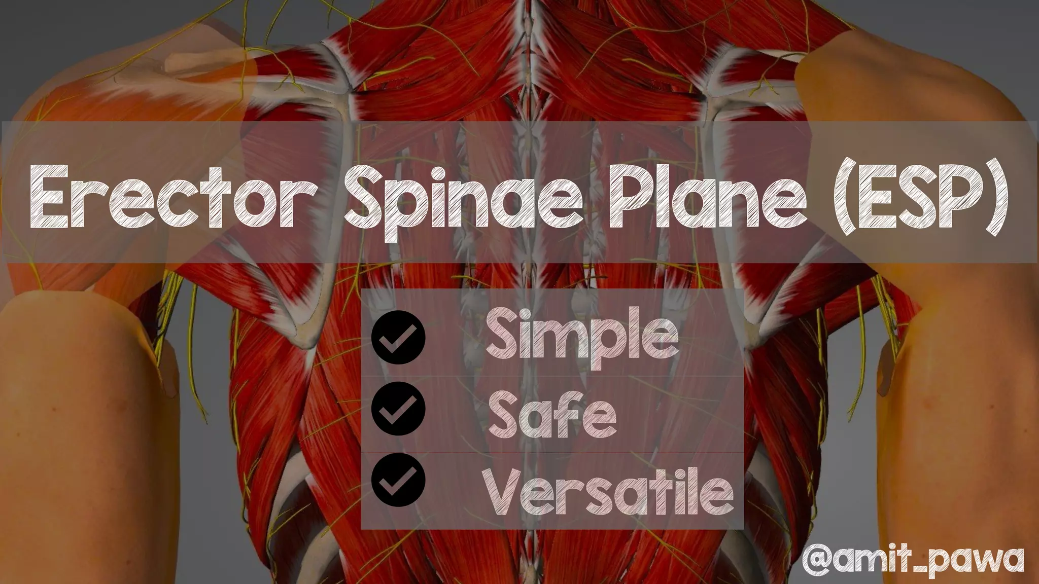 Trunk Blocks - Plan A Blocks - Royal College of Anaesthetists ...
