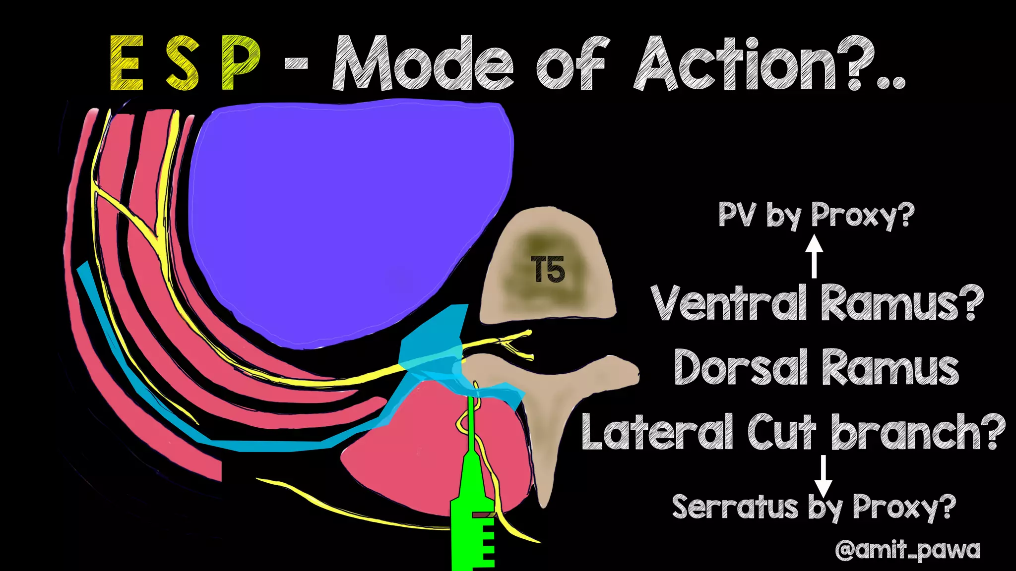 Trunk Blocks - Plan A Blocks - Royal College of Anaesthetists ...