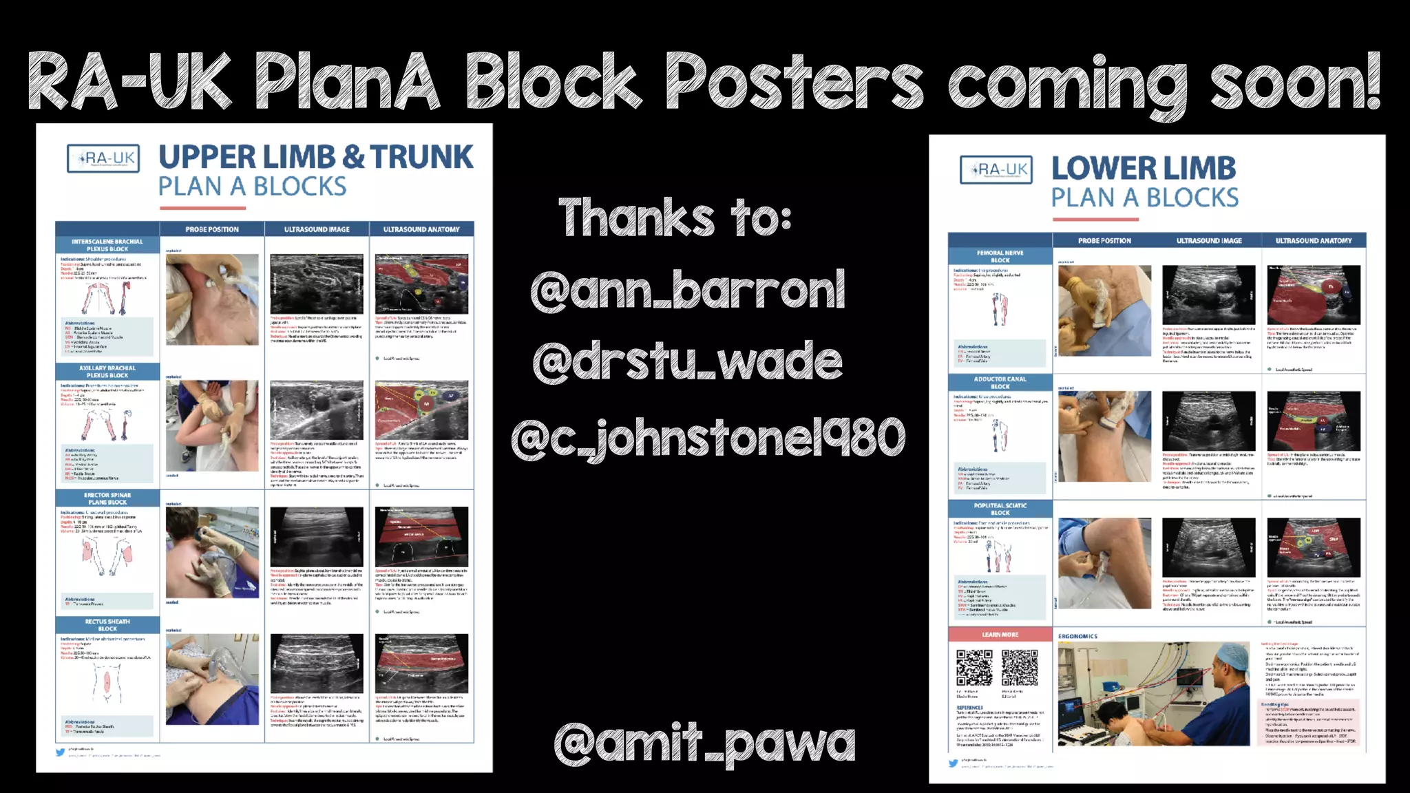 Trunk Blocks - Plan A Blocks - Royal College of Anaesthetists ...