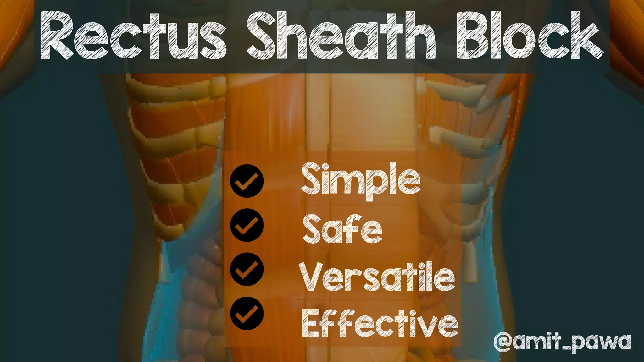 Trunk Blocks - Plan A Blocks - Royal College of Anaesthetists ...