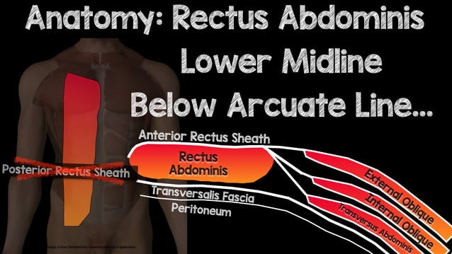 Trunk Blocks - Plan A Blocks - Royal College of Anaesthetists ...