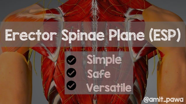 Trunk Blocks - Plan A Blocks - Royal College of Anaesthetists ...
