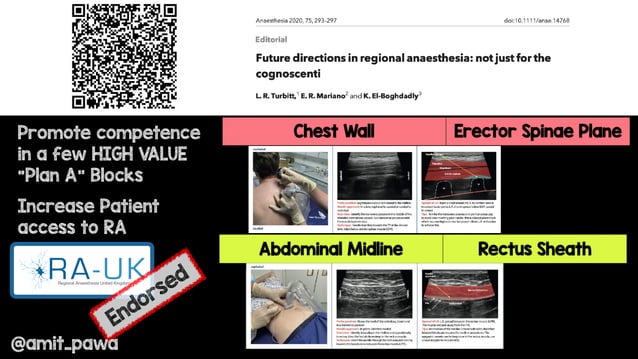 Trunk Blocks - Plan A Blocks - Royal College of Anaesthetists ...