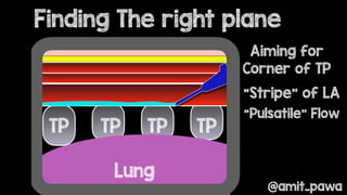 Trunk Blocks - Plan A Blocks - Royal College of Anaesthetists ...