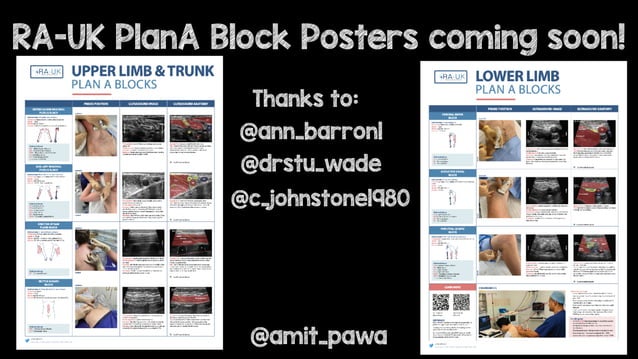 Trunk Blocks - Plan A Blocks - Royal College of Anaesthetists ...