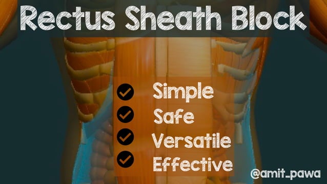 Trunk Blocks - Plan A Blocks - Royal College of Anaesthetists ...