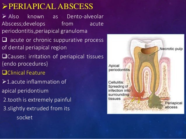 PERIODONTAL LIGAMENT