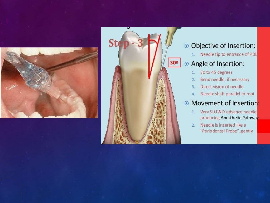 PERIODONTAL LIGAMENT