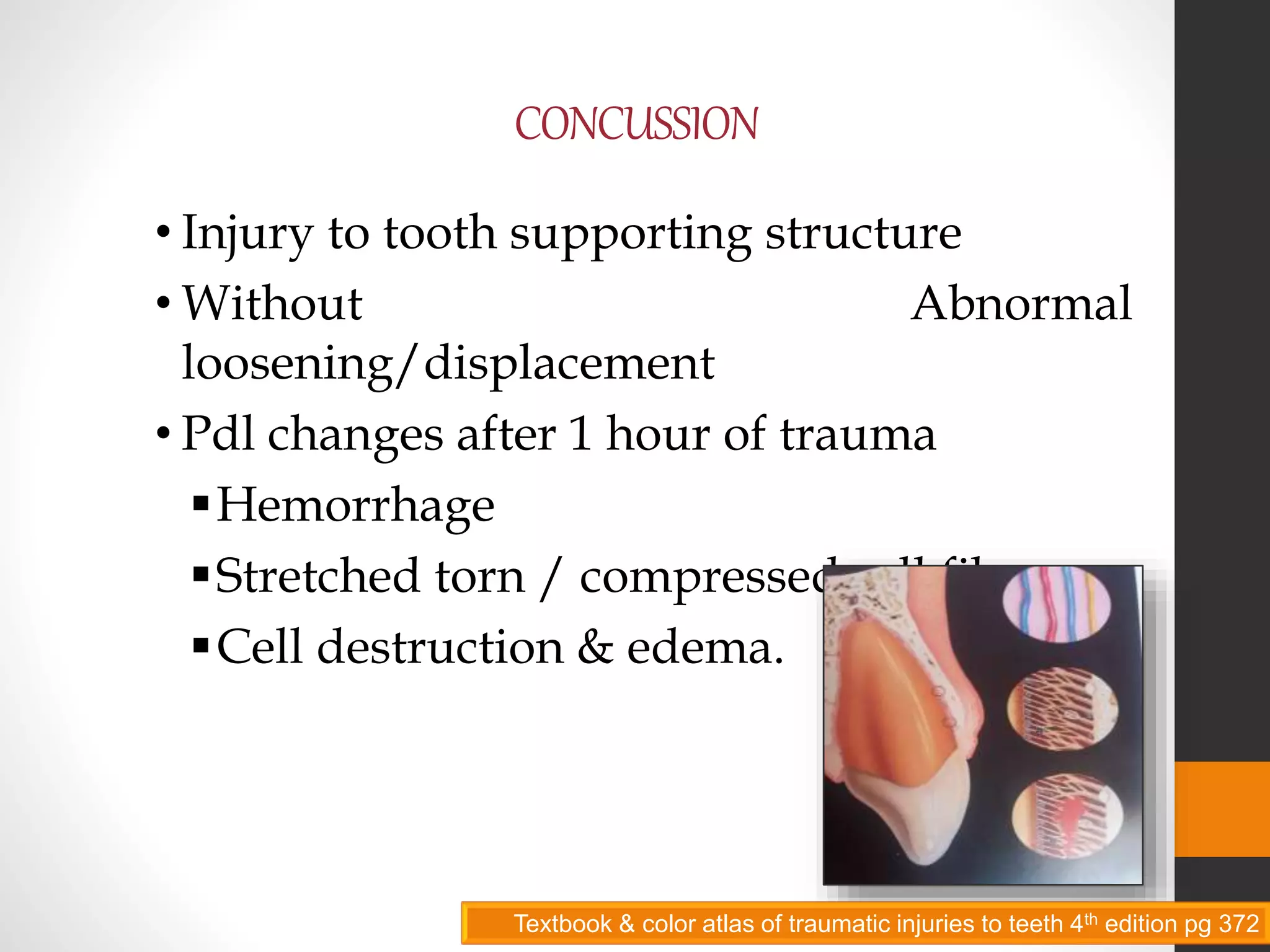 Periodontal ligament (PDL) | PPTX