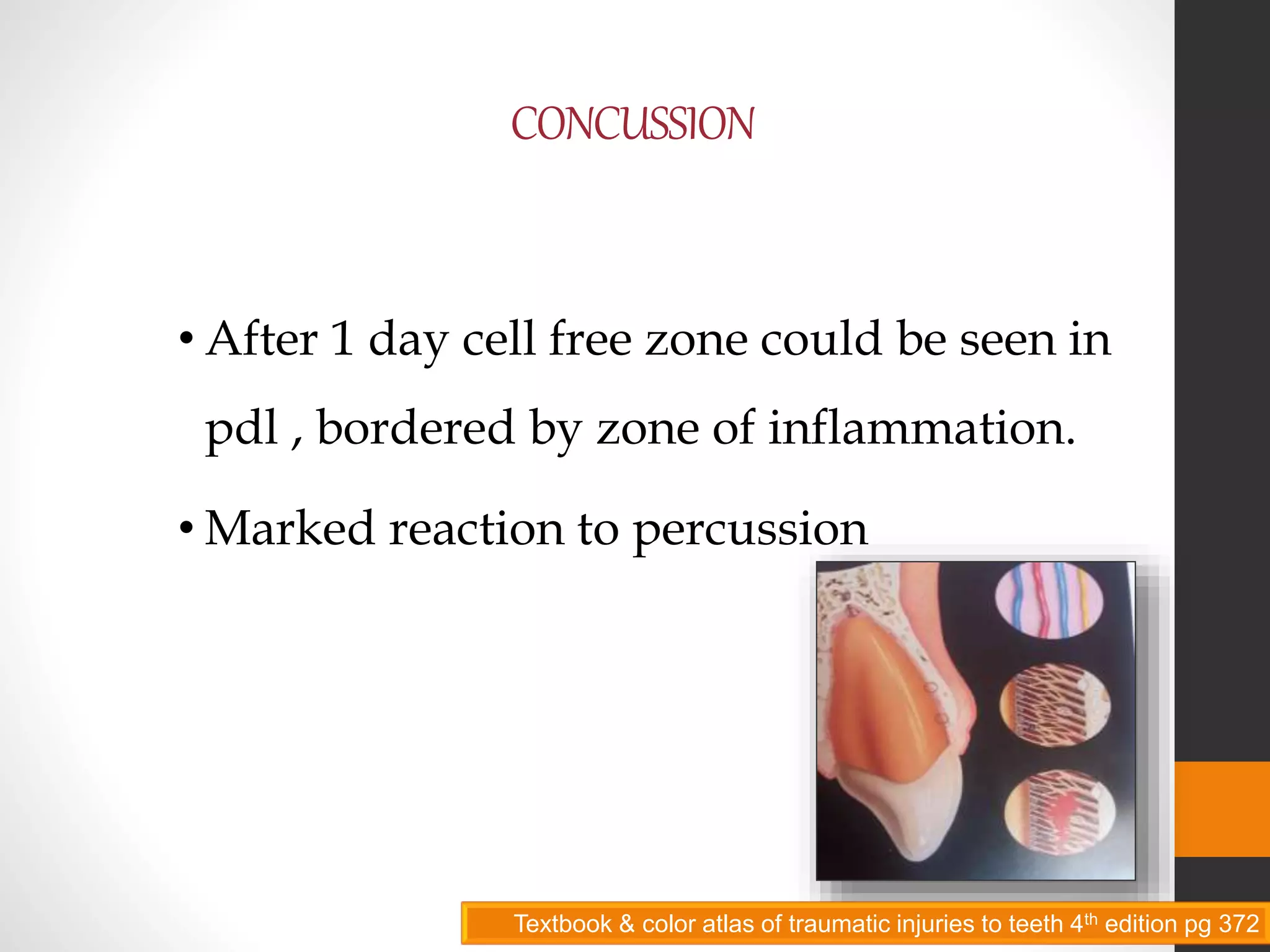 Periodontal ligament (PDL) | PPTX