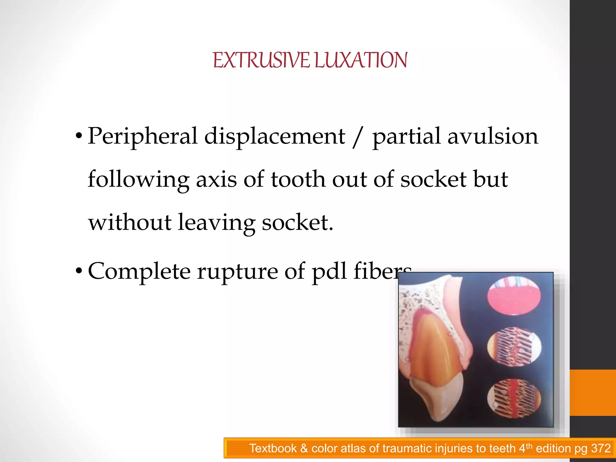 Periodontal ligament (PDL) | PPTX