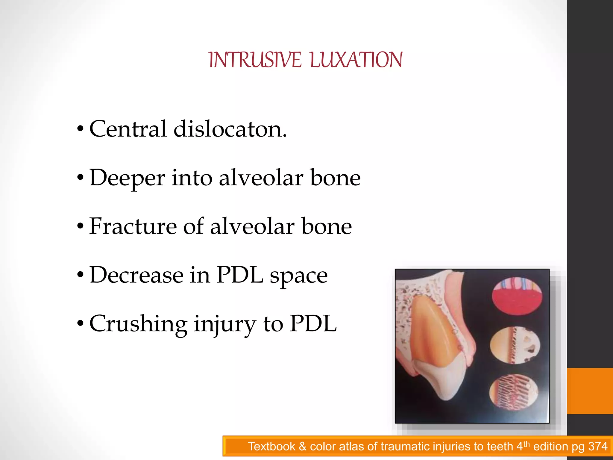 Periodontal ligament (PDL) | PPTX