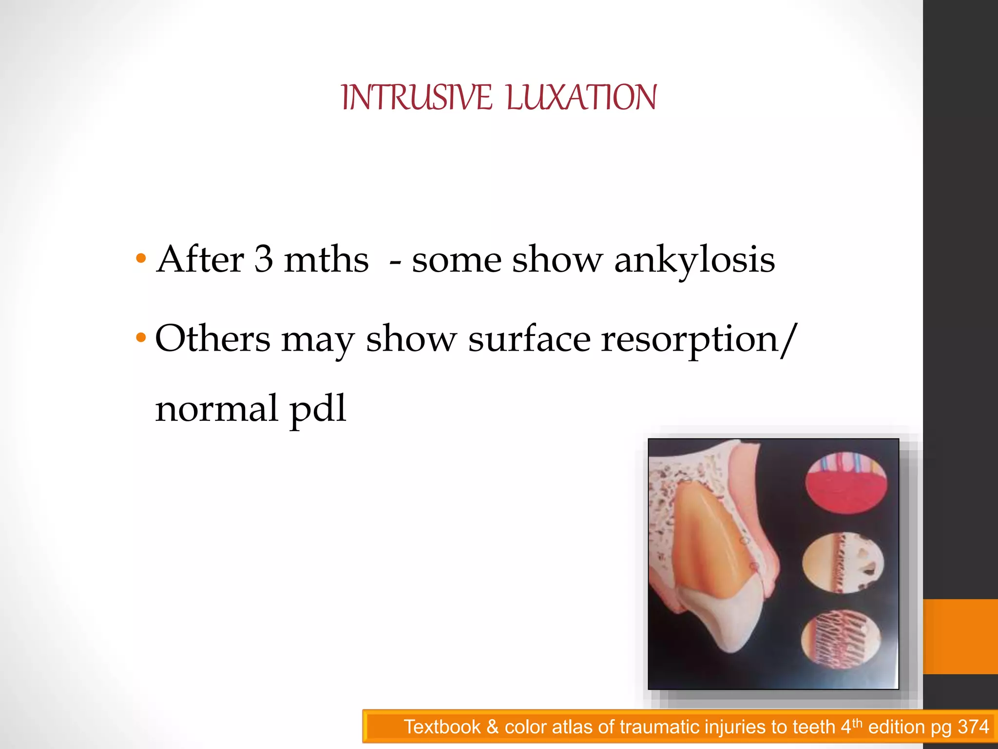 Periodontal ligament (PDL) | PPTX
