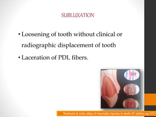 Periodontal ligament (PDL) | PPTX