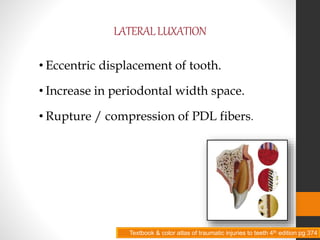 Periodontal ligament (PDL) | PPTX