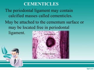 Periodontal ligament : accessory fibers | PPTX | Dental Health ...