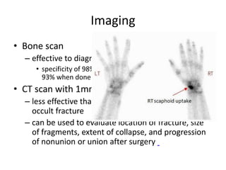Ortho Conference Scaphoid Fracture | PPT