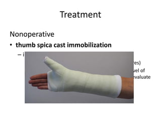 Ortho Conference Scaphoid Fracture | PDF