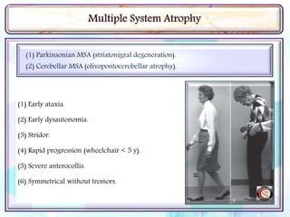 Parkinson Disease MDS criteria | PPTX