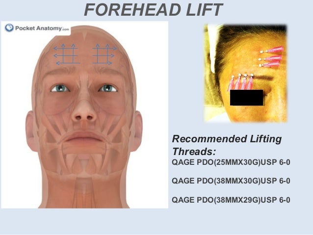 Pdo presentation eng