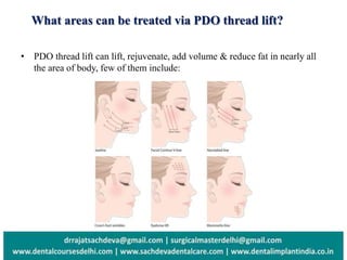 PDO Thread Lift | PPTX