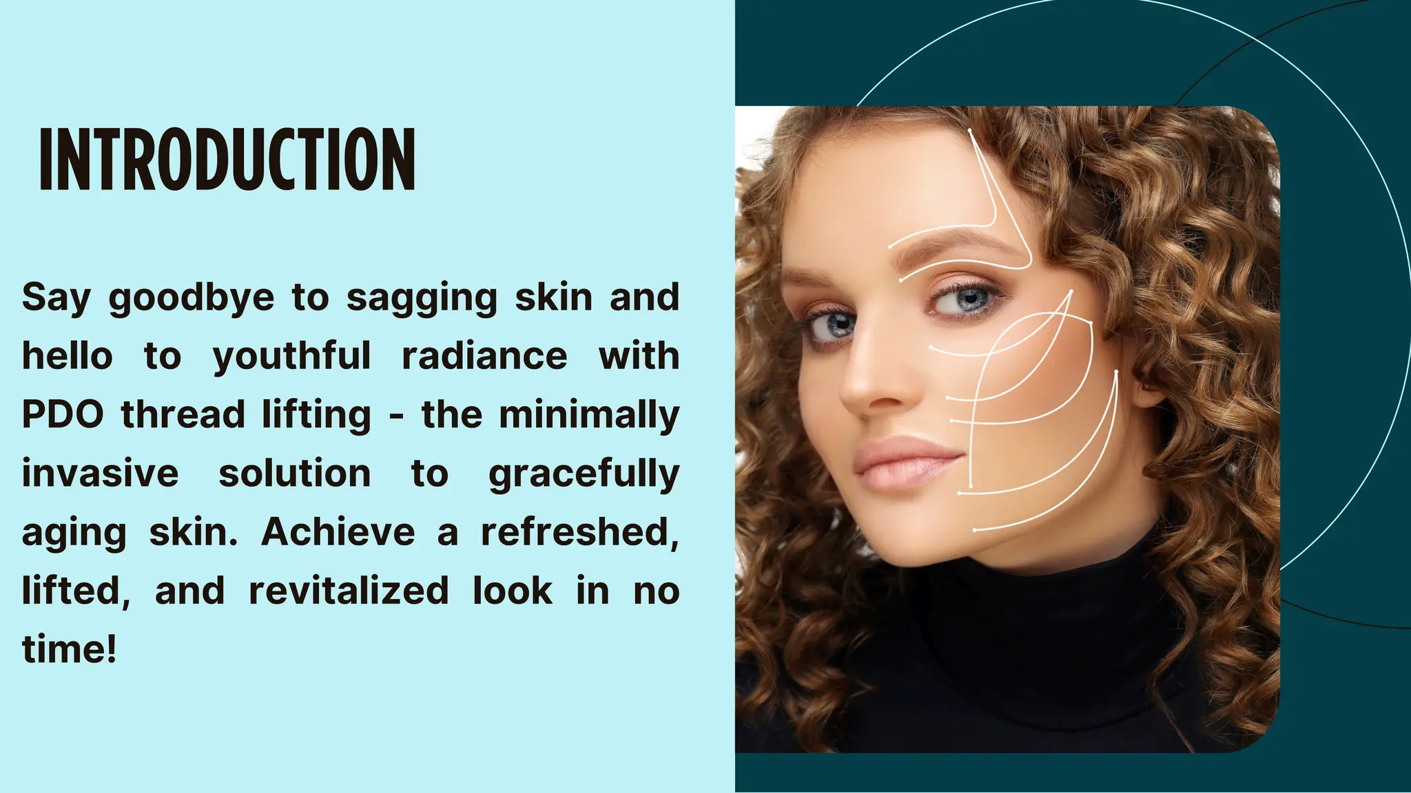 PDO Thread Lifting: The Best Solution for a Youthful Appearance! | PDF