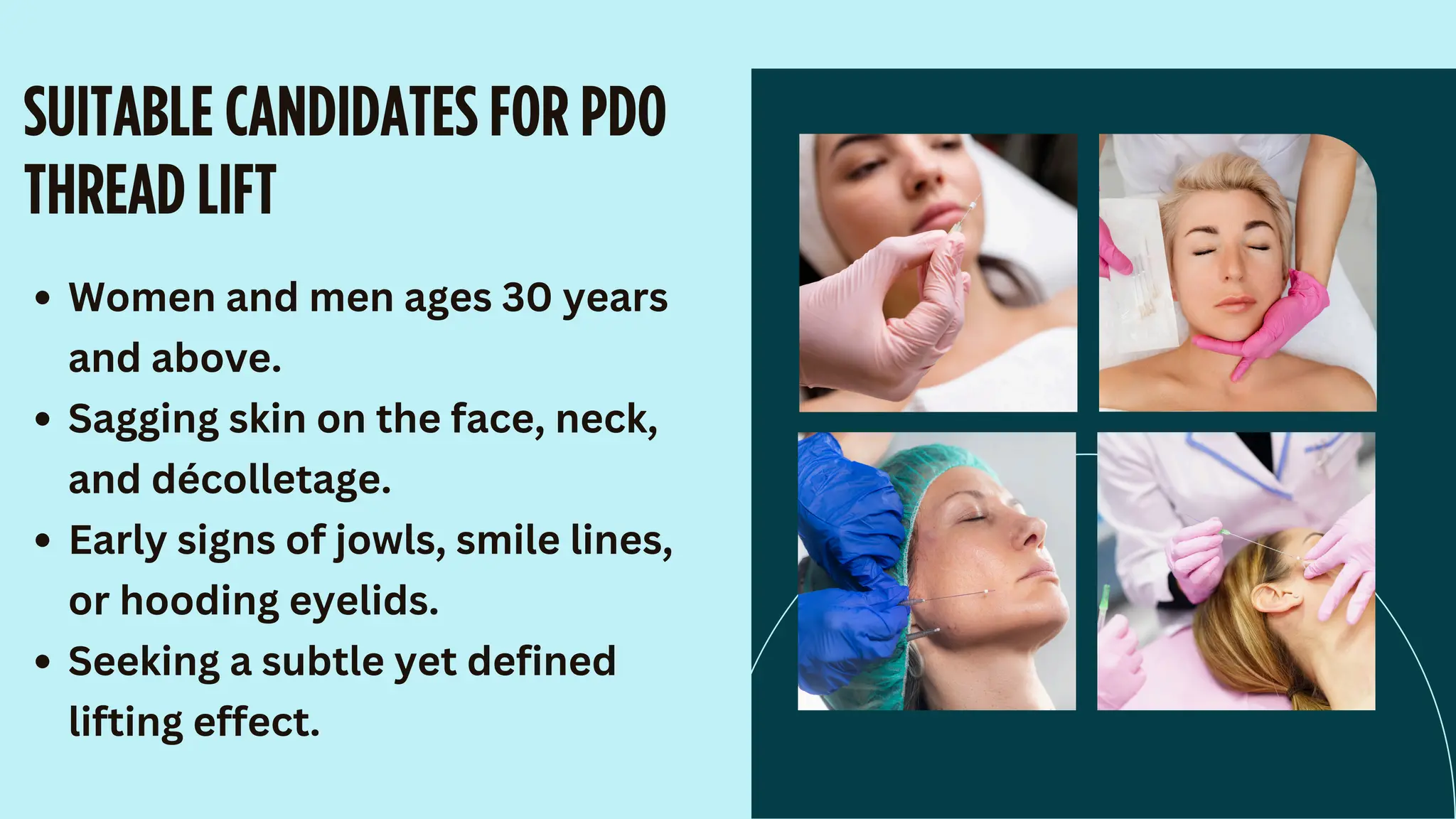 PDO Thread Lifting: The Best Solution for a Youthful Appearance! | PDF ...