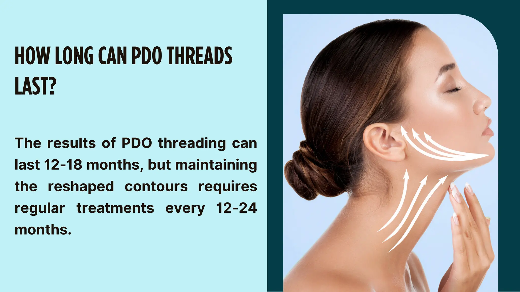 PDO Thread Lifting: The Best Solution for a Youthful Appearance! | PDF