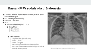 PDPI web _H1N1 dan HMPV virus respiratorypptx | PPTX