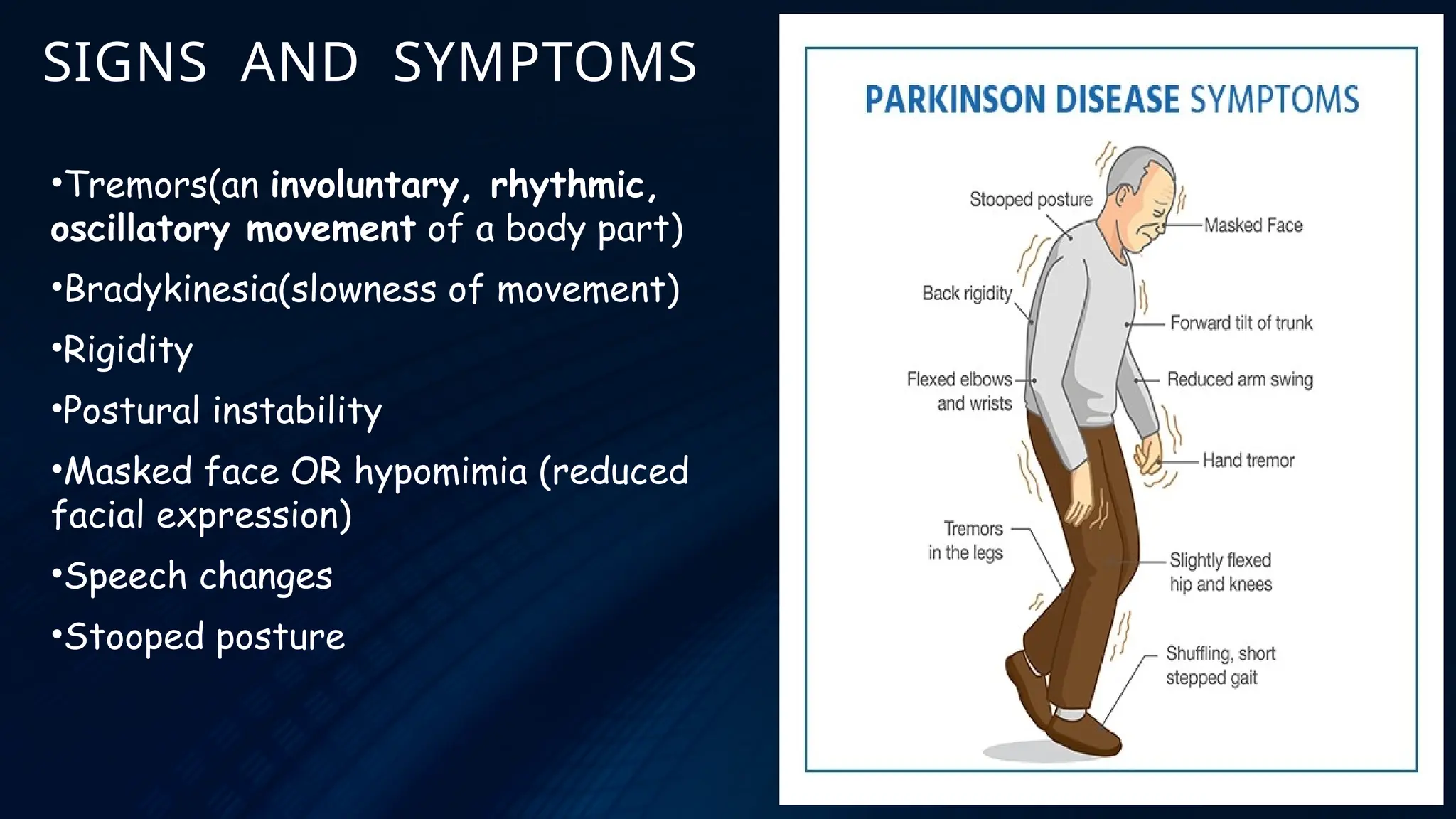 Overview of Parkinson’s disease :- Etiology, types, pathogenesis,signs ...