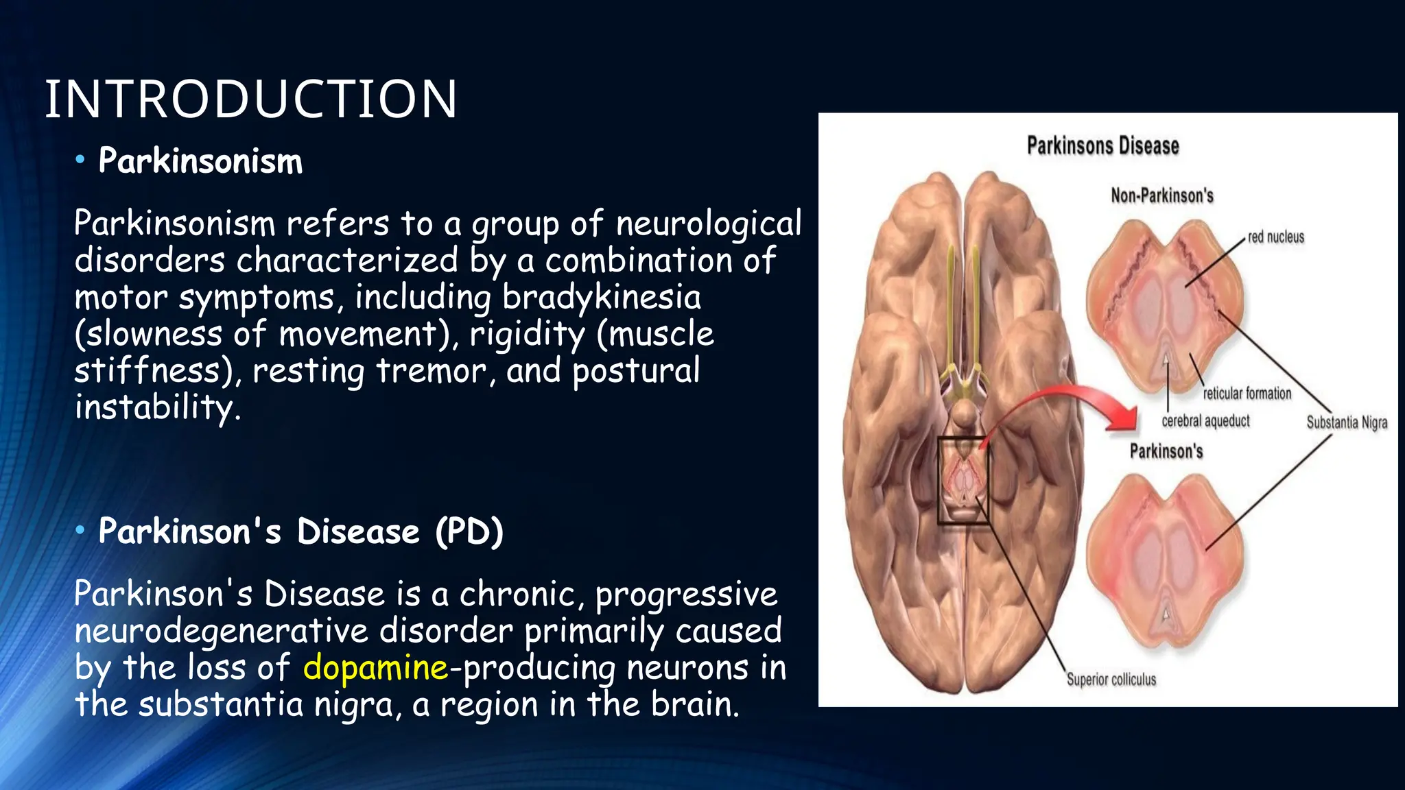Overview of Parkinson’s disease :- Etiology, types, pathogenesis,signs,treatement ...